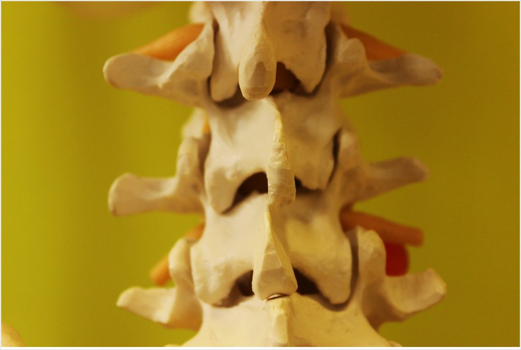 Fisioterapia en Cervicalgia o dolor cervical - Corpore Fisioterapia